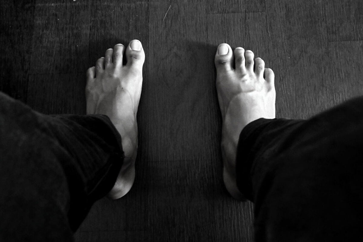 Treatment for Fractured Sesamoid Bone in Foot - Fracture Healing