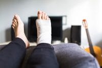 Pott's Fractures: A Guide to Healing | Fracture Healing