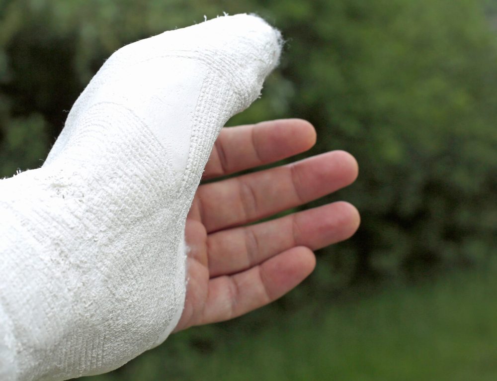 Broken Bone or Sprain | How to Tell | Fracture Healing