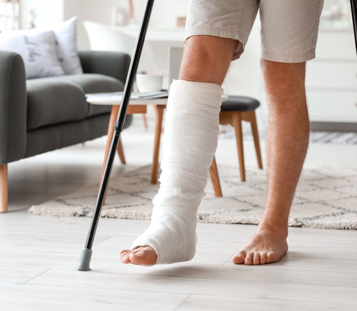 Tibia Fracture Healing Time: What to Expect | Fracture Healing