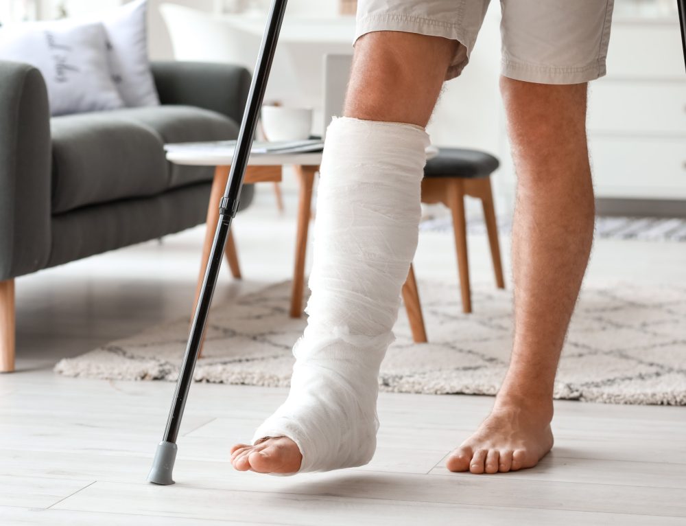 5 Stages of Fracture Healing - Fracture Healing