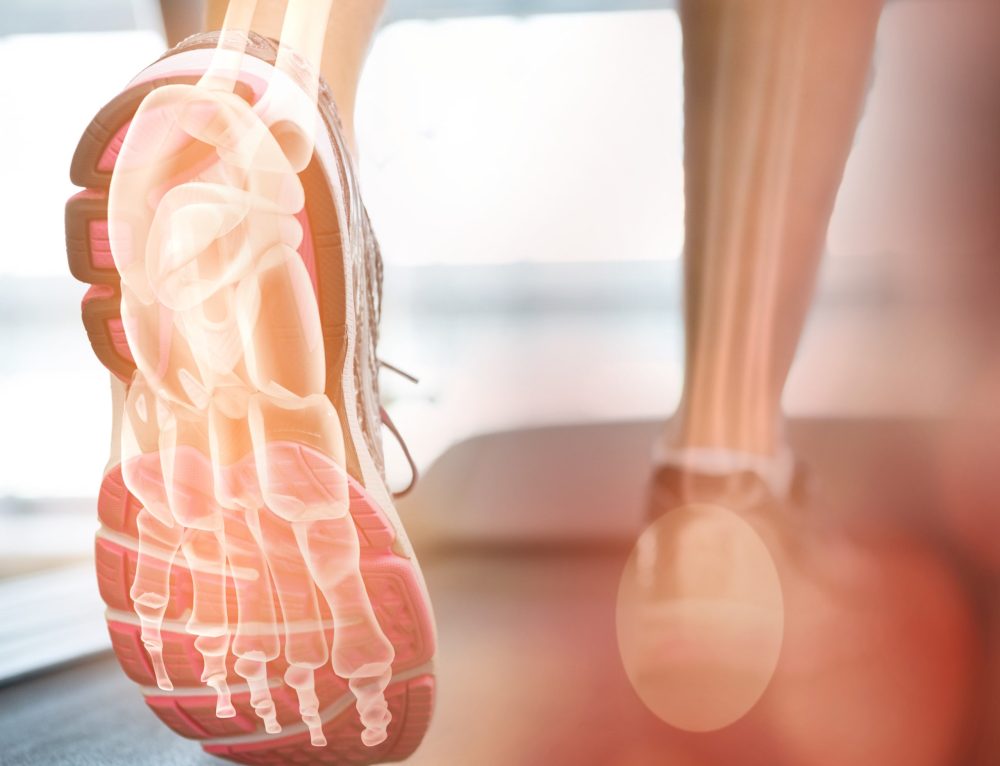 Choosing the Right Bone Growth Stimulator | Fracture Healing